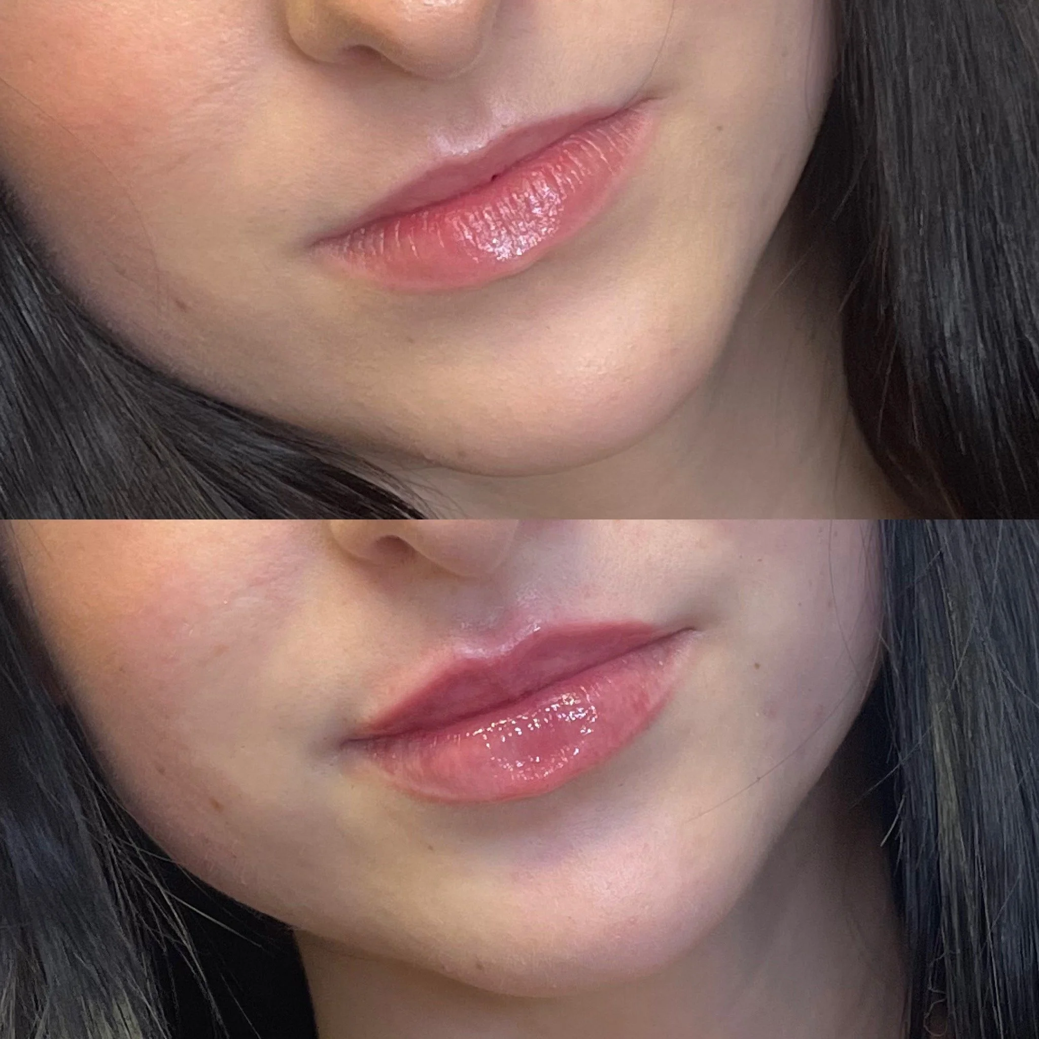 OUR WORK — Calypso Aesthetic Lab