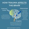 What Is EMDR & How Can It Help With Trauma — Therapy-Thoughts