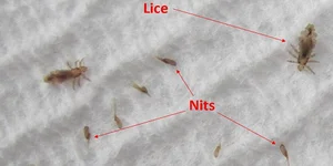Classroom Lice Tips — Teacher Questions - Advice and Freebies for New ...