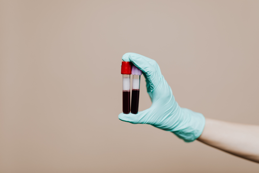 Hormone Testing on Birth Control: What You Need to Know — Dr. Brittany ...