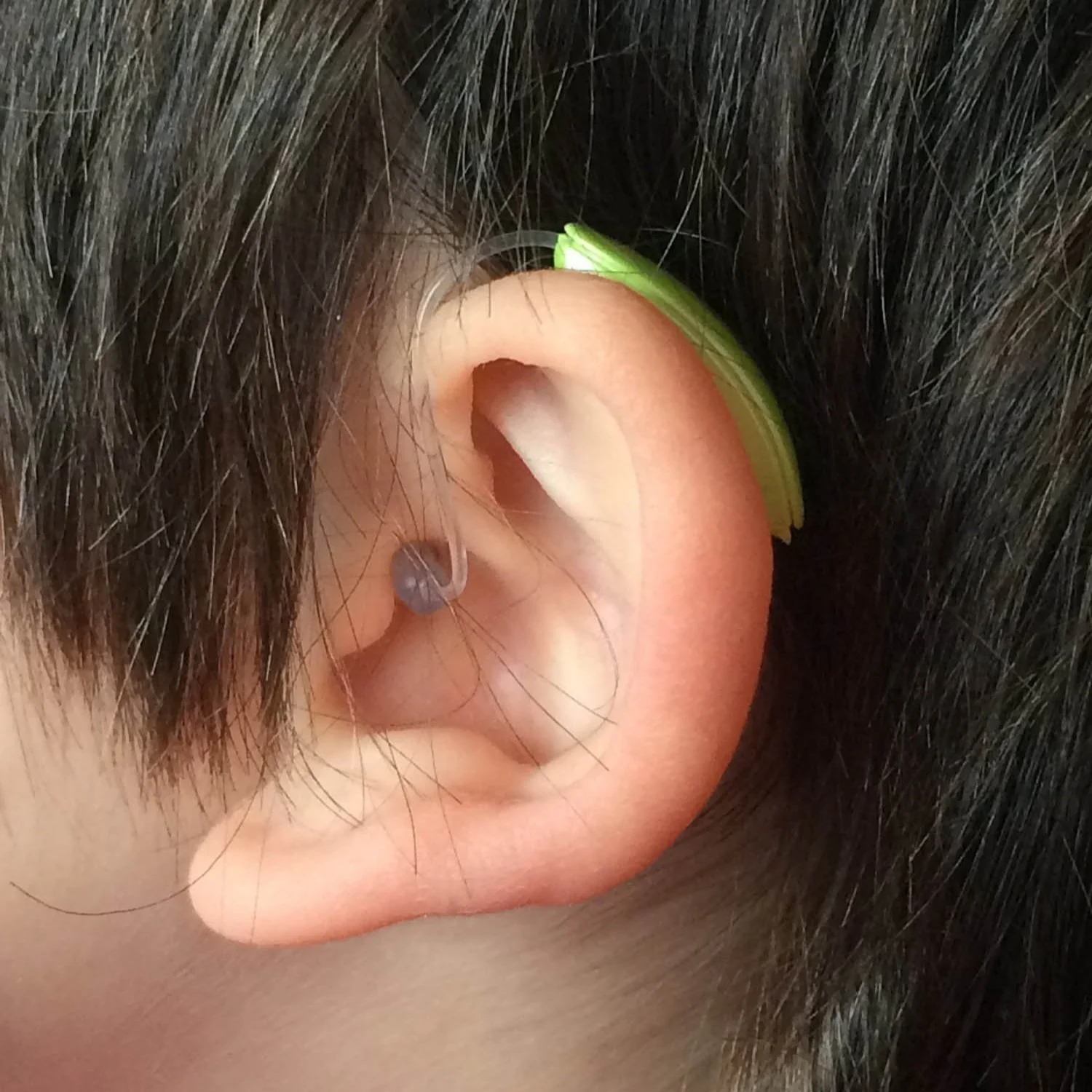 Children’s Hearing Aids