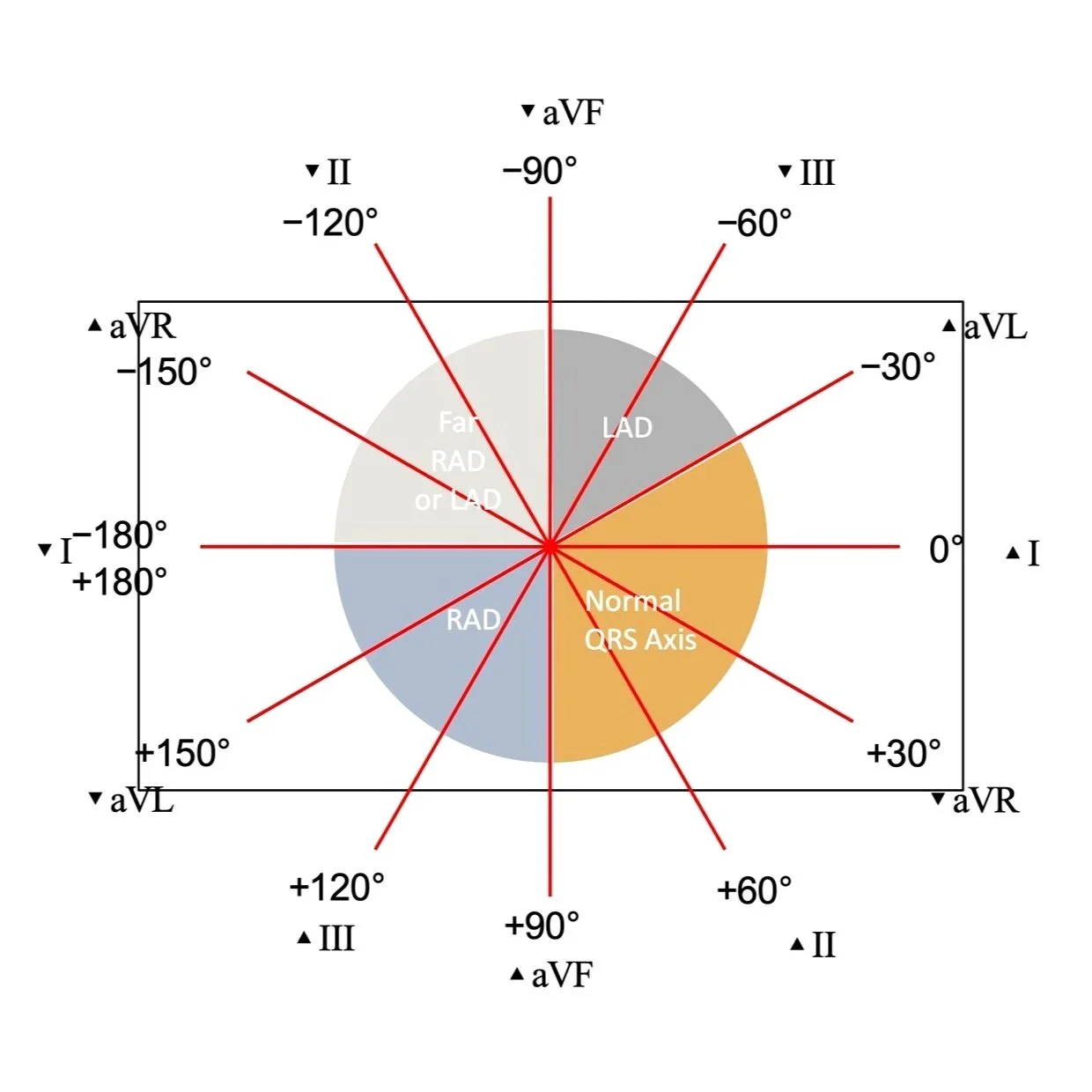 EKG for Dummies — PEDIATRIC PULSE