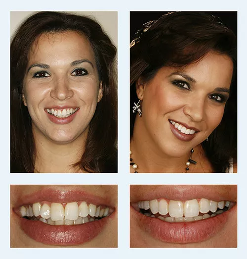Dentist in Bryan, TX - Radiant Exceptional Dentistry