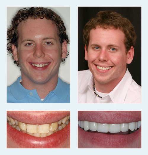 Dentist Bryan TX — Radiant Exceptional Dentistry