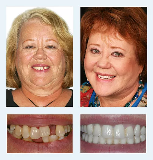 Dentist in Bryan, TX - Radiant Exceptional Dentistry