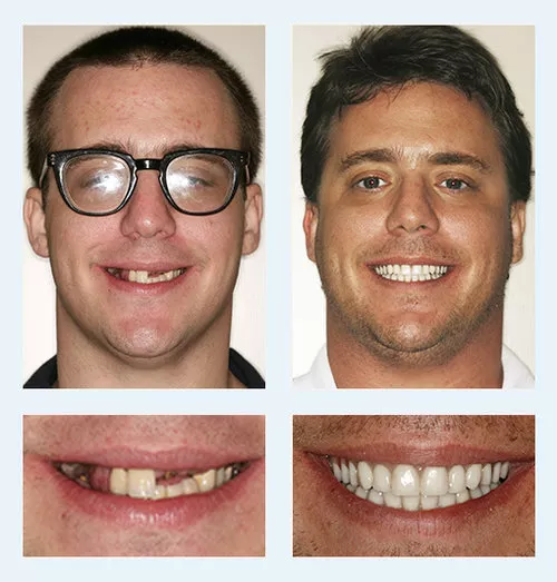 Dentist in Bryan, TX - Radiant Exceptional Dentistry