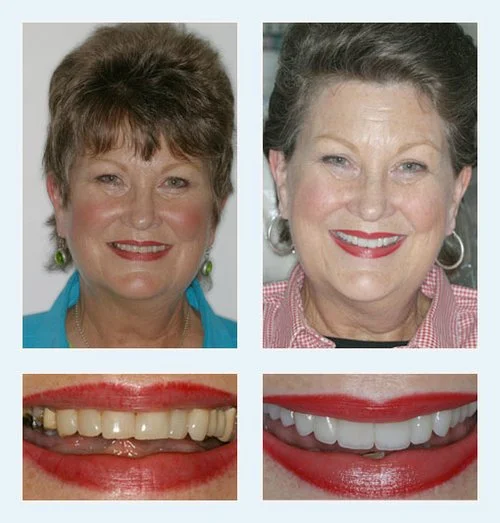 Dentist Bryan TX — Radiant Exceptional Dentistry