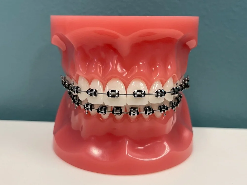 How To Take Care Of My Dental Braces