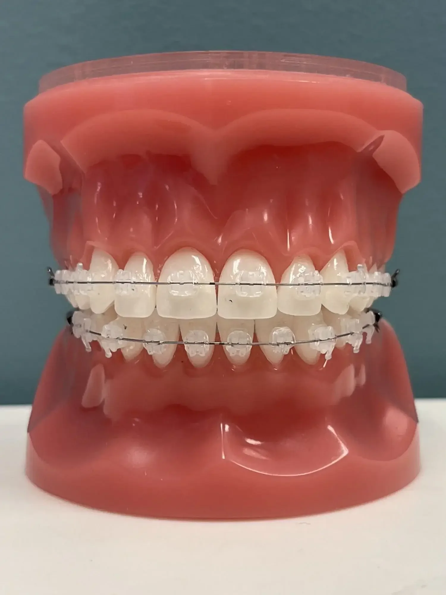 Clear Braces in Los Angeles | Affordable & Invisible