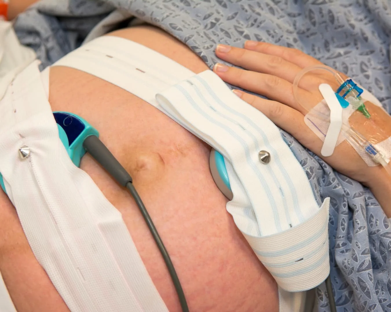 What to Know About Birth Trauma - Treatment for Birth Trauma