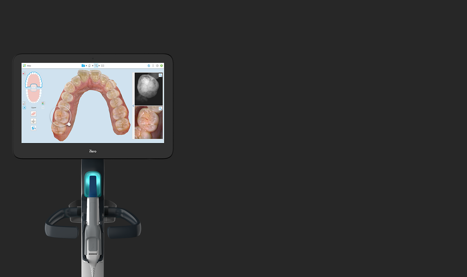 Dental Lab | Vertex Dental Studio