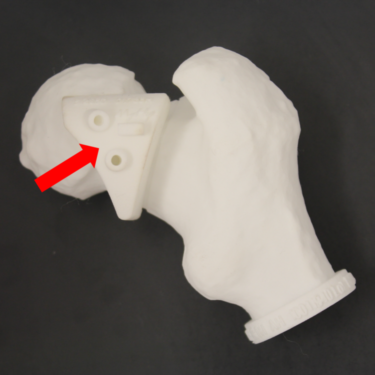 CASE 43: Using 3D printed guides to achieve the best possible position ...