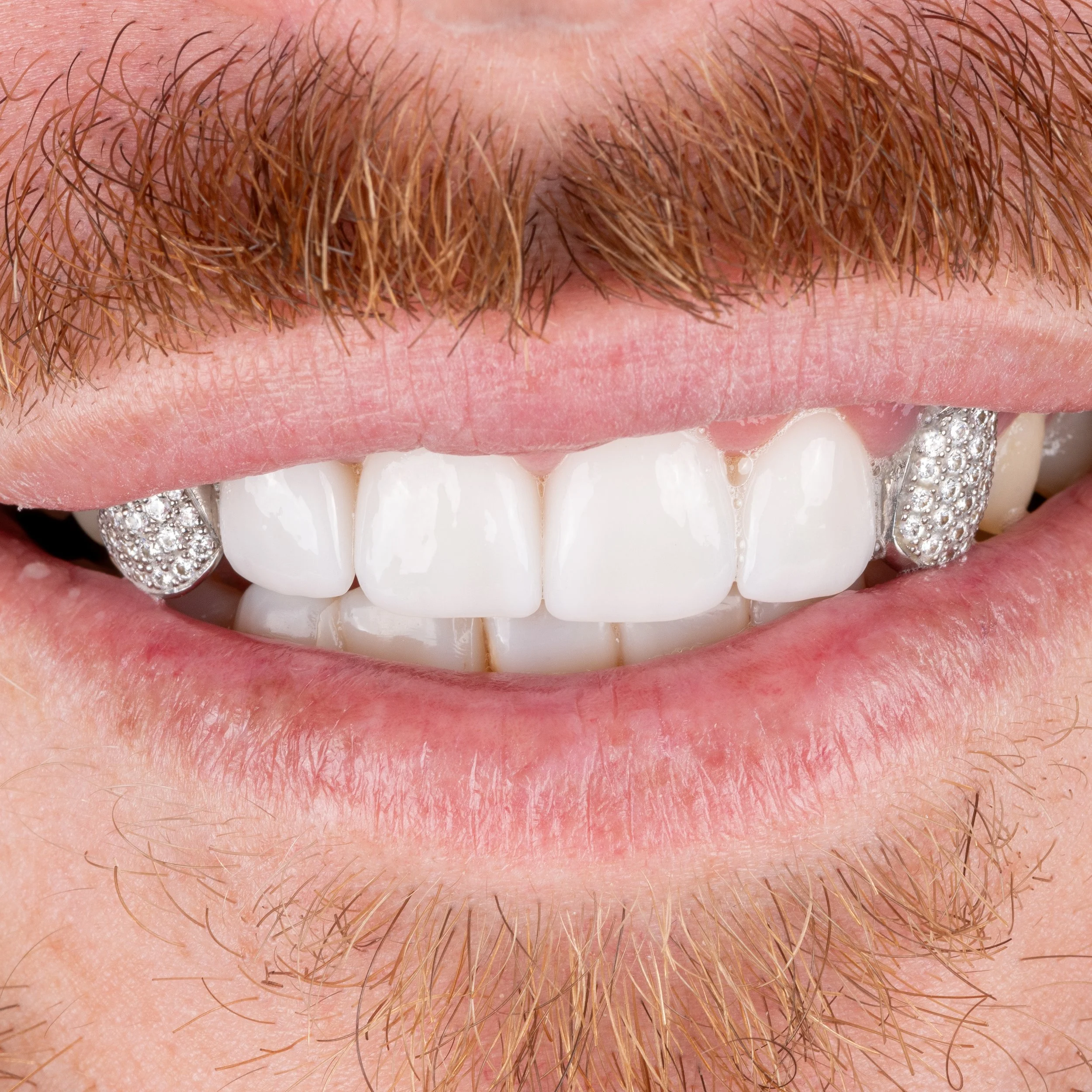 Cosmetic Dentists | Ace Dental Studio - Gold Coast