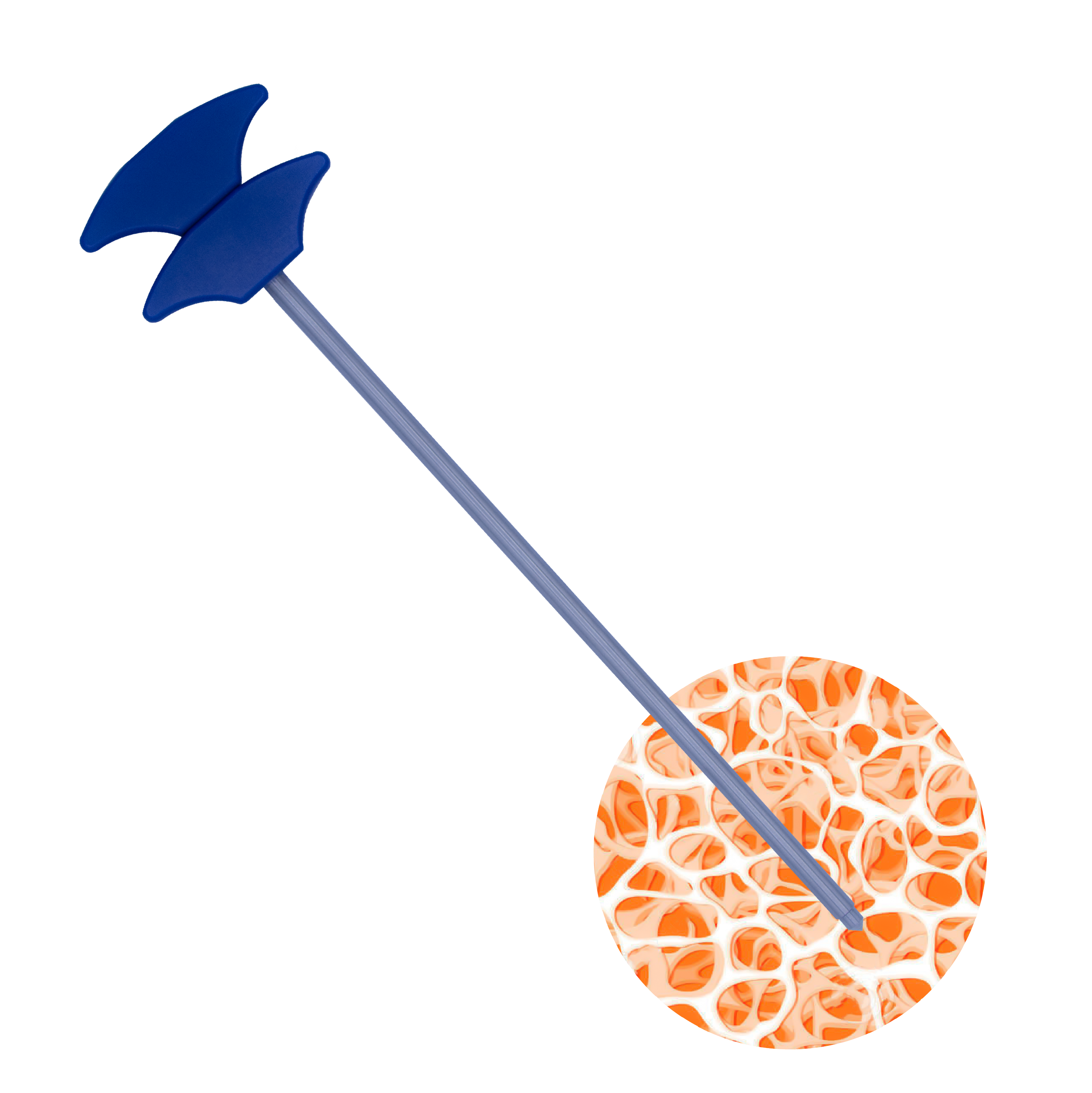 InFill AFM Advanced Fusion Matrix Orthobiologic — Camber Spine Med Tech
