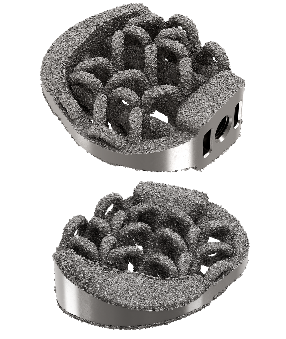 SPIRA-O — Camber Spine Med Tech