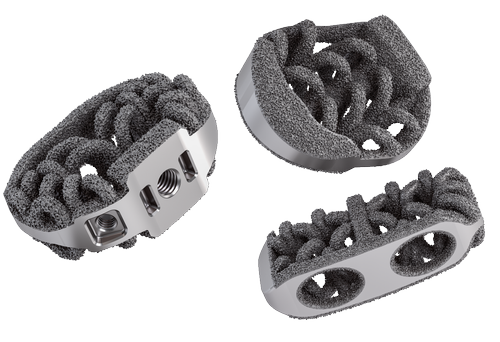 SPIRA Technology — Camber Spine Med Tech