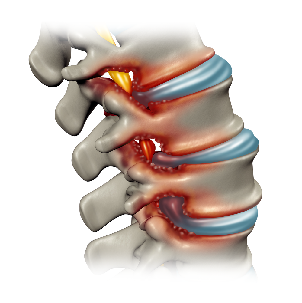 Learn The Basics of Spinal Anatomy — Camber Spine Med Tech