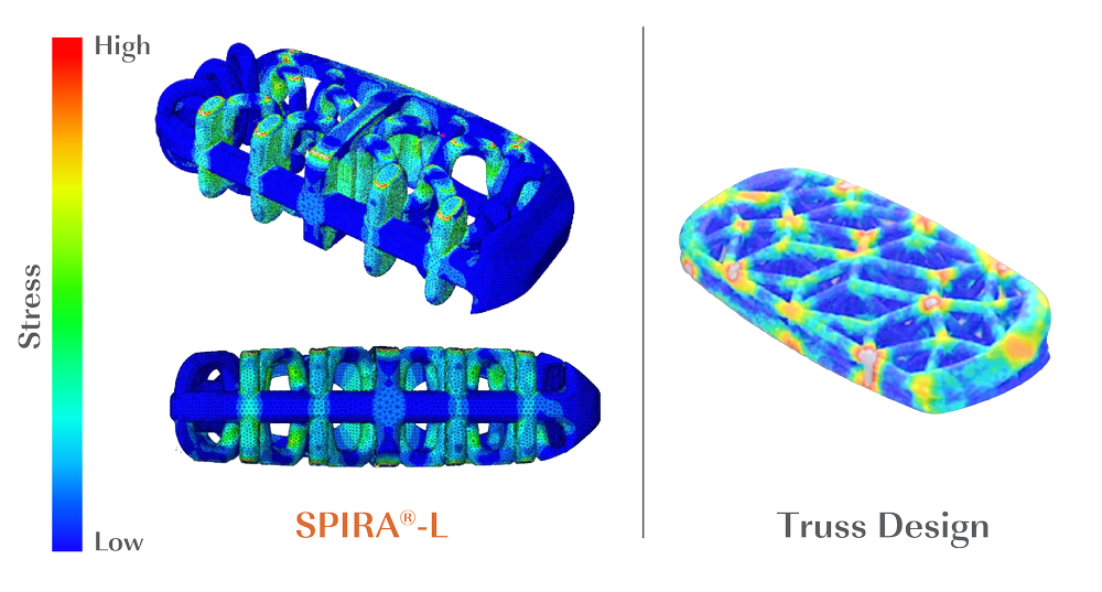 SPIRA Technology — Camber Spine Med Tech