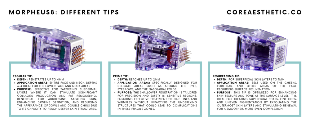 Unlock the Secrets of Morpheus8: Expert Tips for Tailored Facial ...