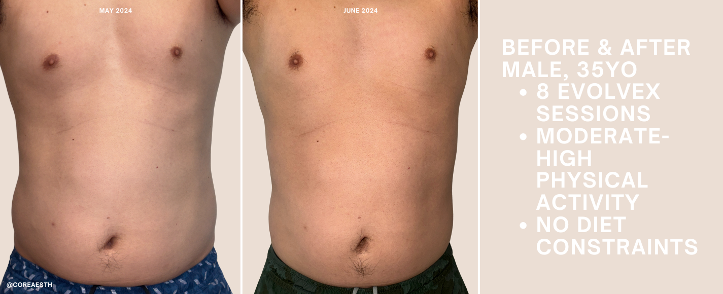 How EvolveX Transform Melts Stomach Fat: Comprehensive Guide | Core ...