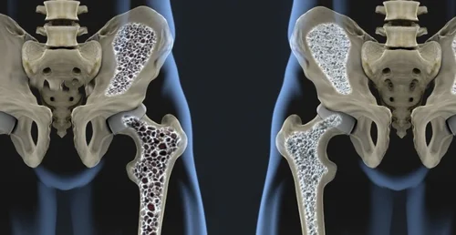 Building Stronger Bones: The Impact of Strength Training on Bone ...