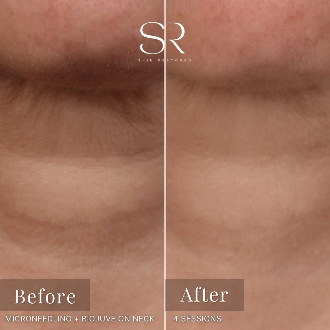 SKIN.RESTORED