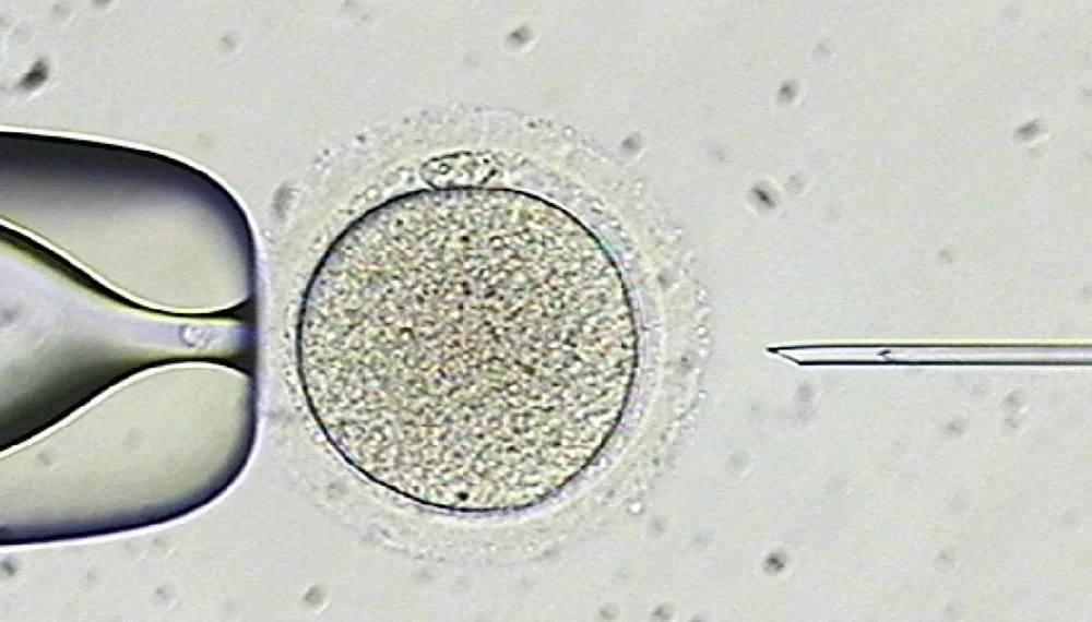 How Eggs Are Fertilized in the Lab: ICSI vs. Conventional Insemination ...