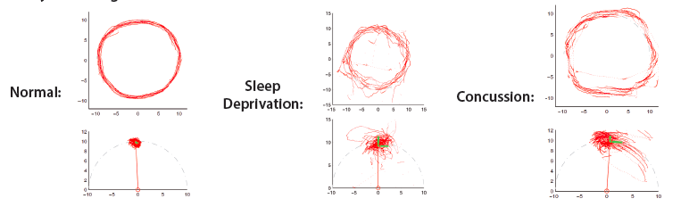 Brain Trauma Foundation - Concussion — Brain Trauma Foundation