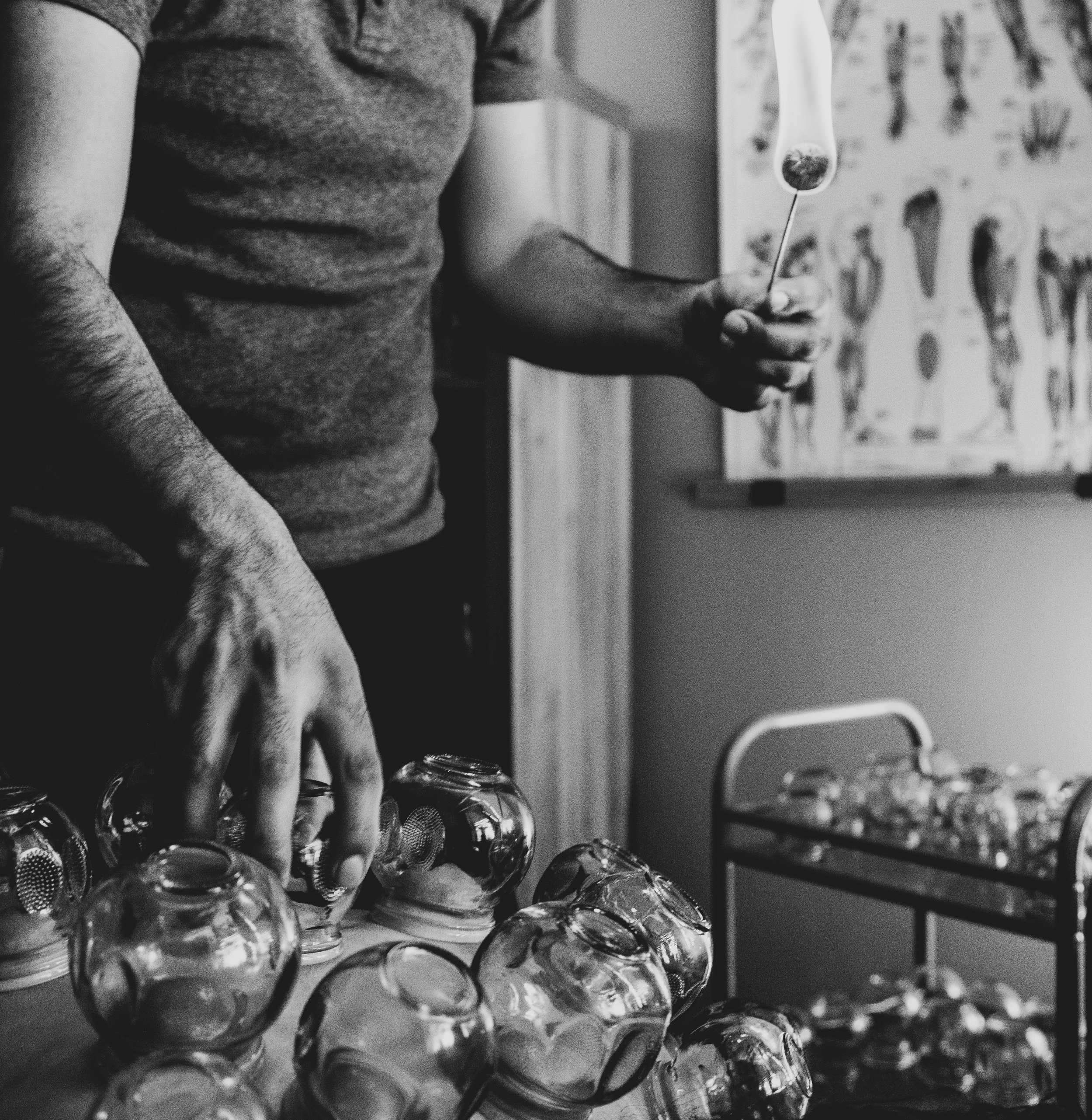 Authentic Fire Cupping Therapy, Minneapolis: Traditional Chinese ...