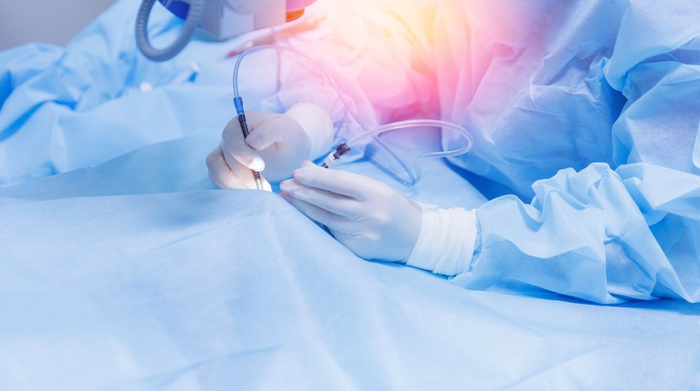 Ophthalmologist Johannesburg - Eye Specialist - Cataract Surgery - LASIK