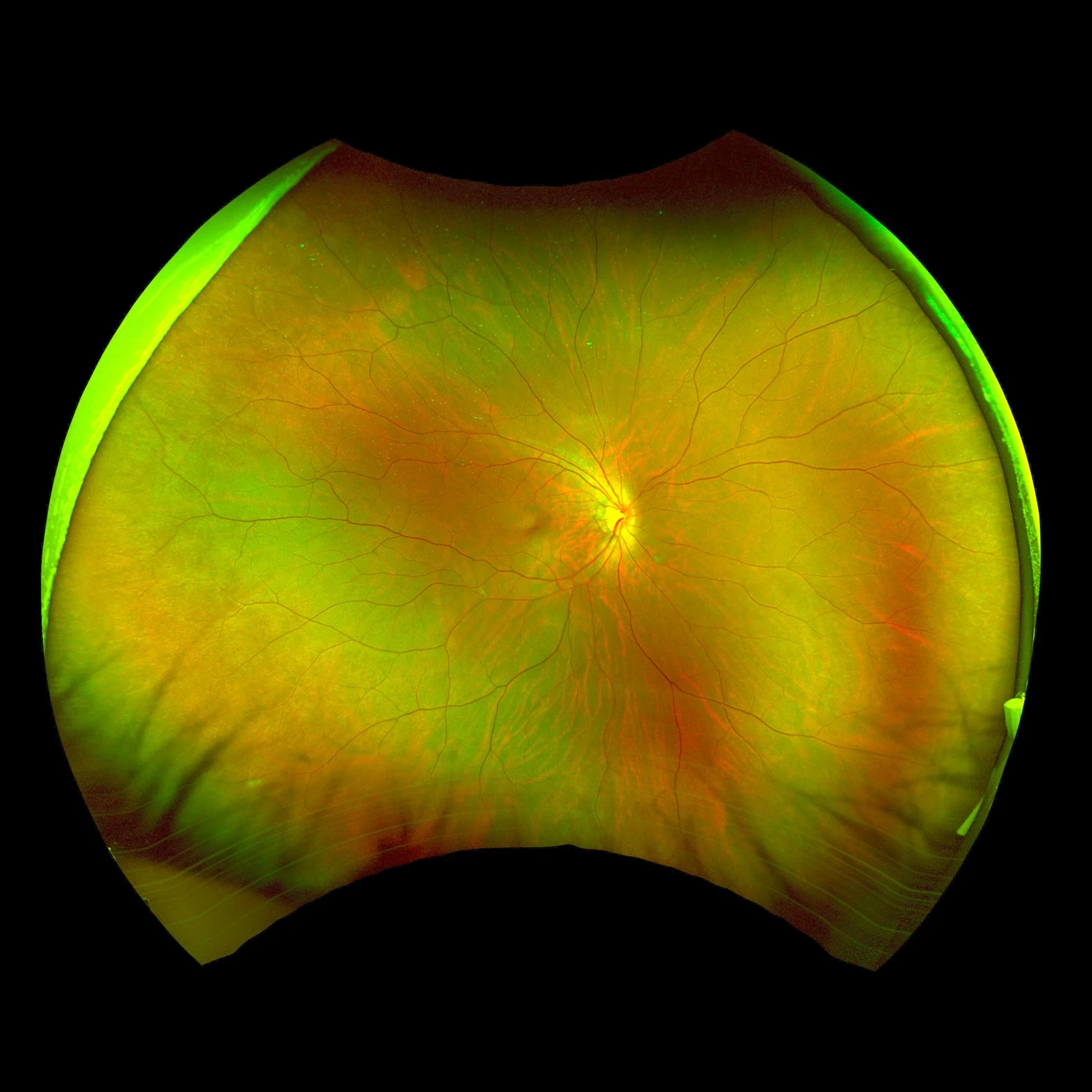 Yun Eye Care: Samuel Yun Ophthalmology