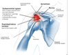 The Effect of Posture on Shoulder Pain | From a Top Physical Therapist ...