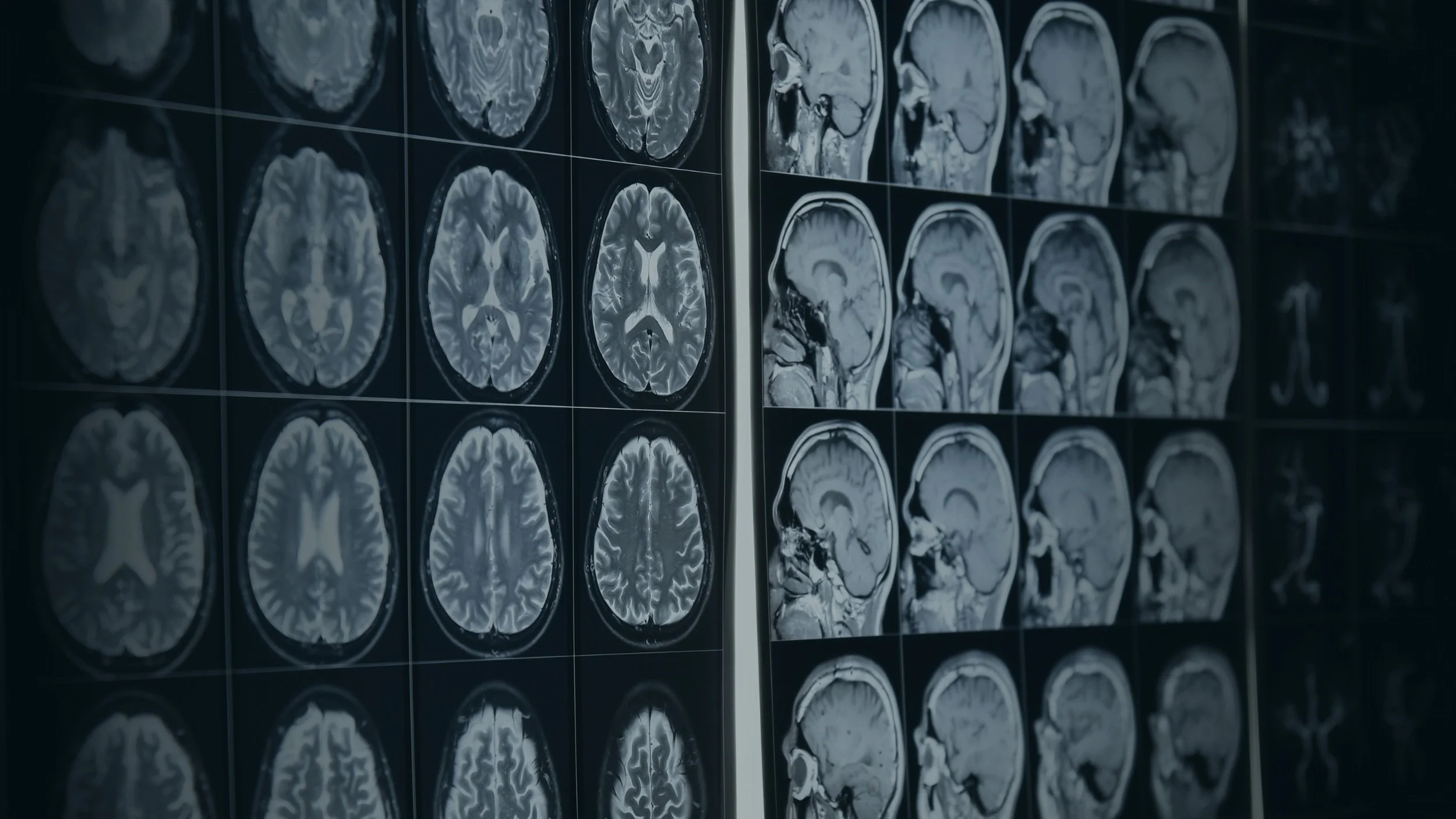 The Anxiety Spiral: Understanding and Unraveling the Cycle of Worry ...