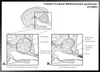 COMS and Syringomyelia in Dogs — Remedy Veterinary Specialists