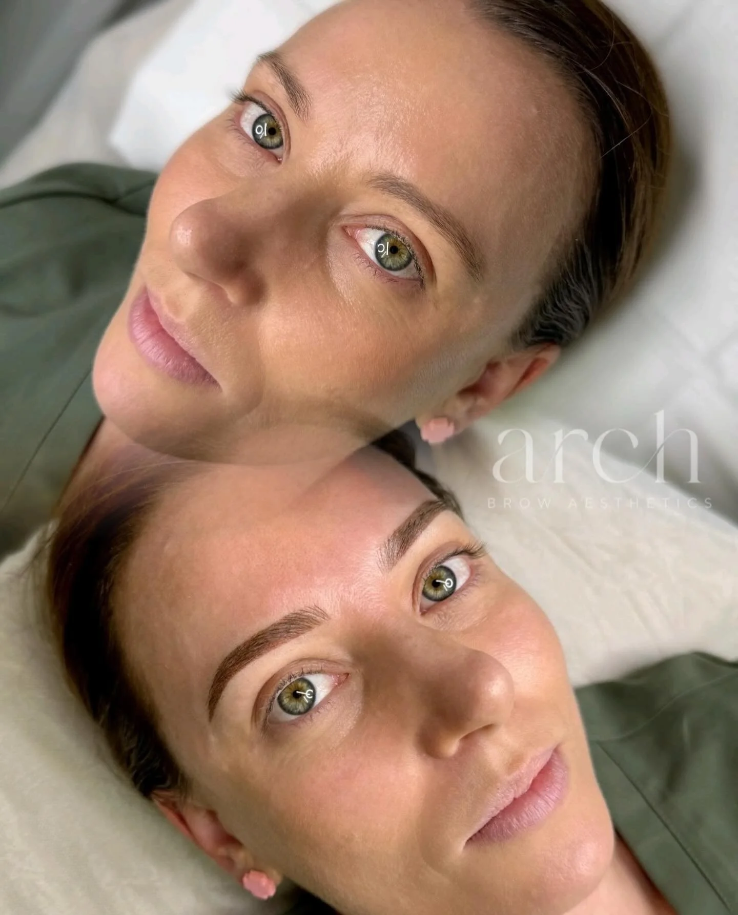 Arch Brow Aesthetics