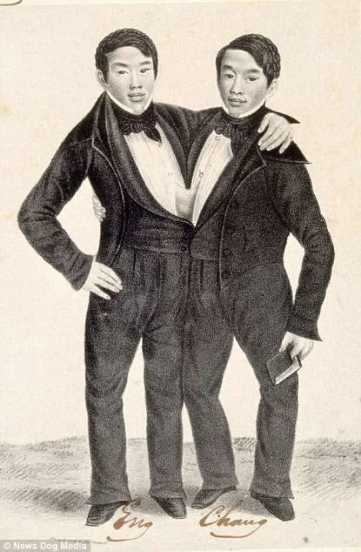 Chang & Eng Bunker - The Siamese Twins — Disability Throughout History