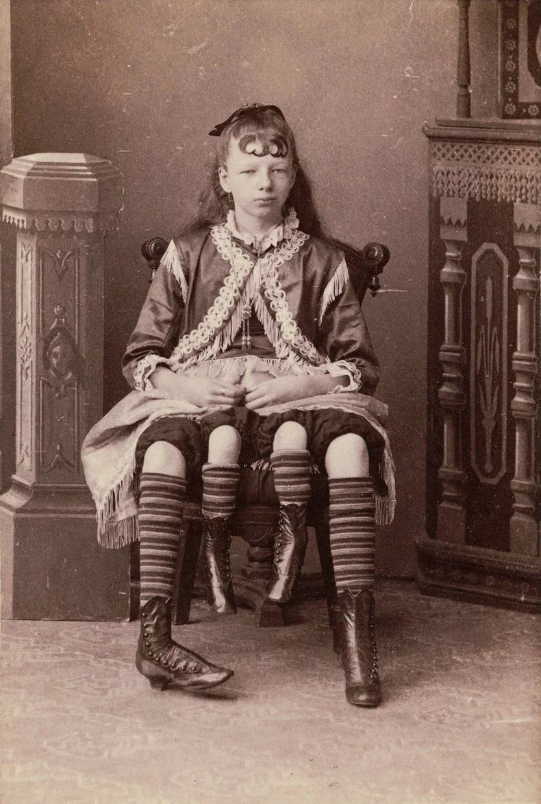 Ella Harper & Myrtle Corbin - More Than a Curiosity — Disability ...