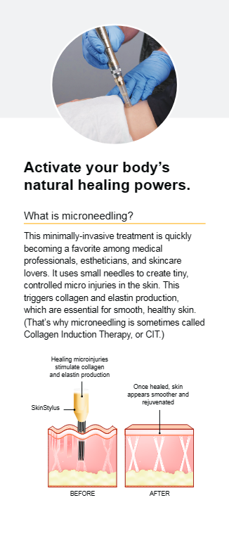 Microneedling — Refresh Ashland