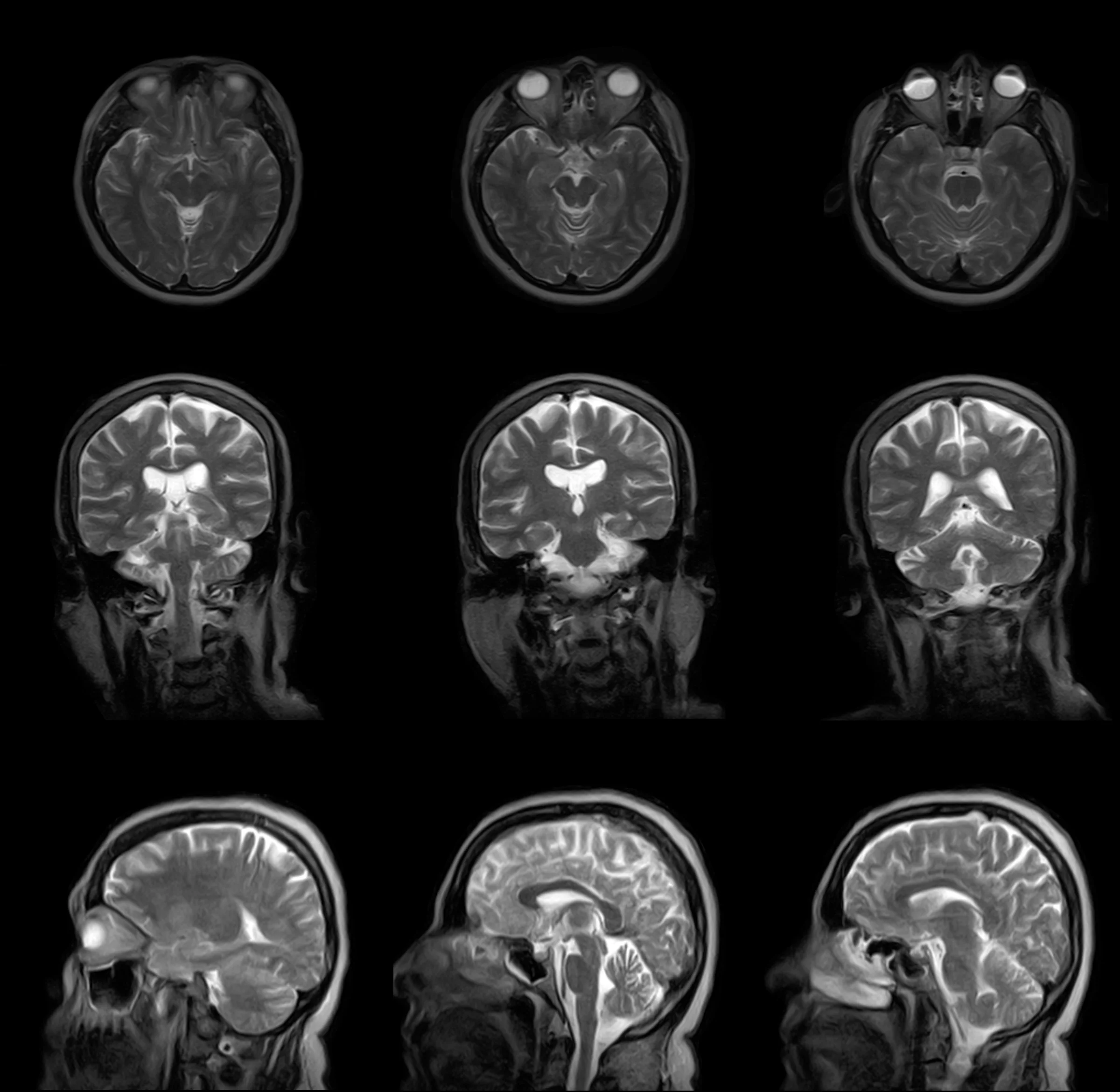 Top Imaging Center | MRI | X-Ray | Garden Grove | Orange County