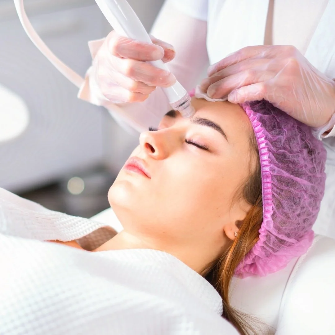 Laser Facial Treatments | Lost Art Laser & Tattoo Removal — Lost Art ...