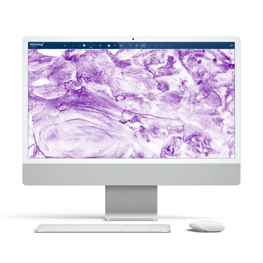 SamanTree Medical - Real-time Interoperative Imaging