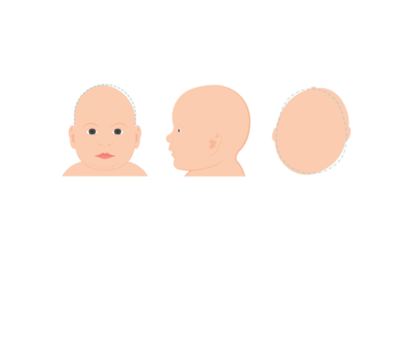 Flat Head Syndrome — The Well Chiropractic