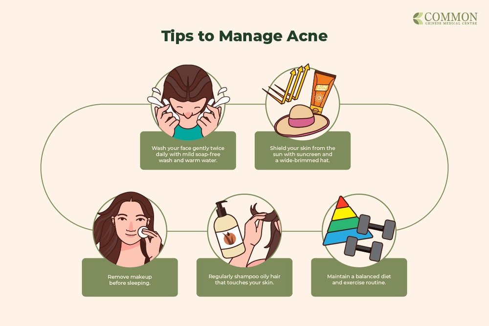 Managing Acne Using Traditional Chinese Medicine (TCM) Treatment