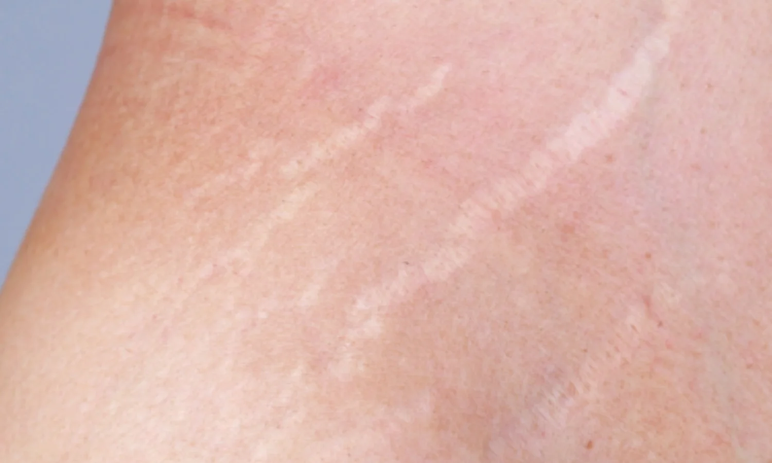 Indicaties — Beauty Secrets Anne