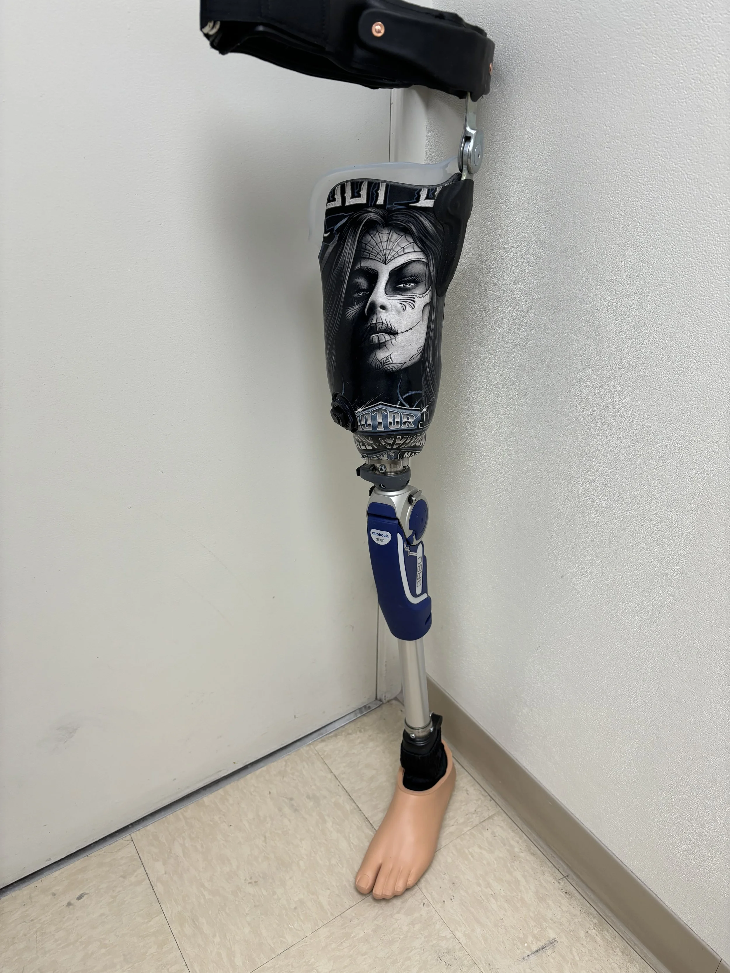 Prosthetics & Orthotics Photo Gallery — Clinical Prosthetics and ...