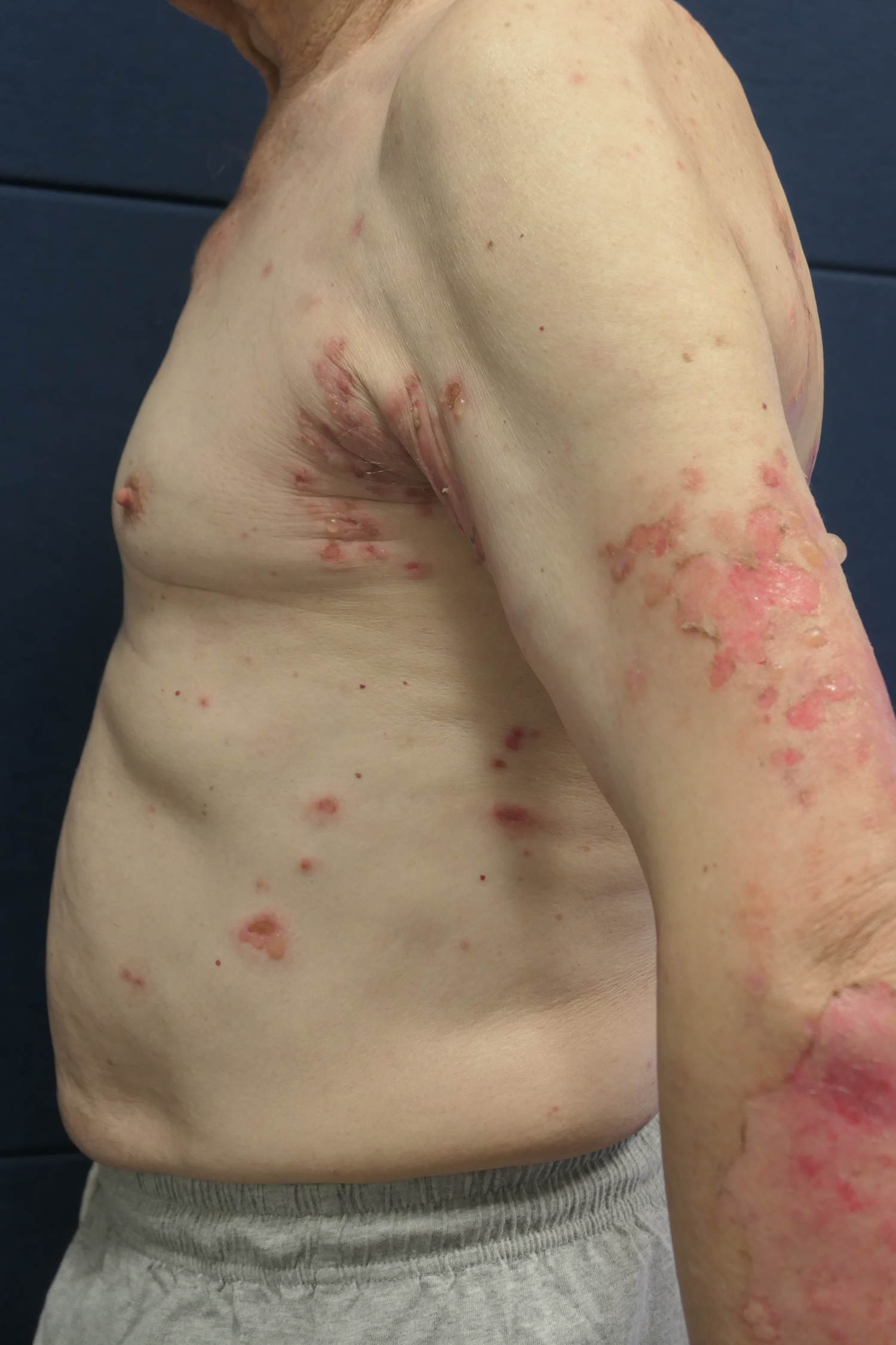 Services — Australasian Blistering Diseases Foundation