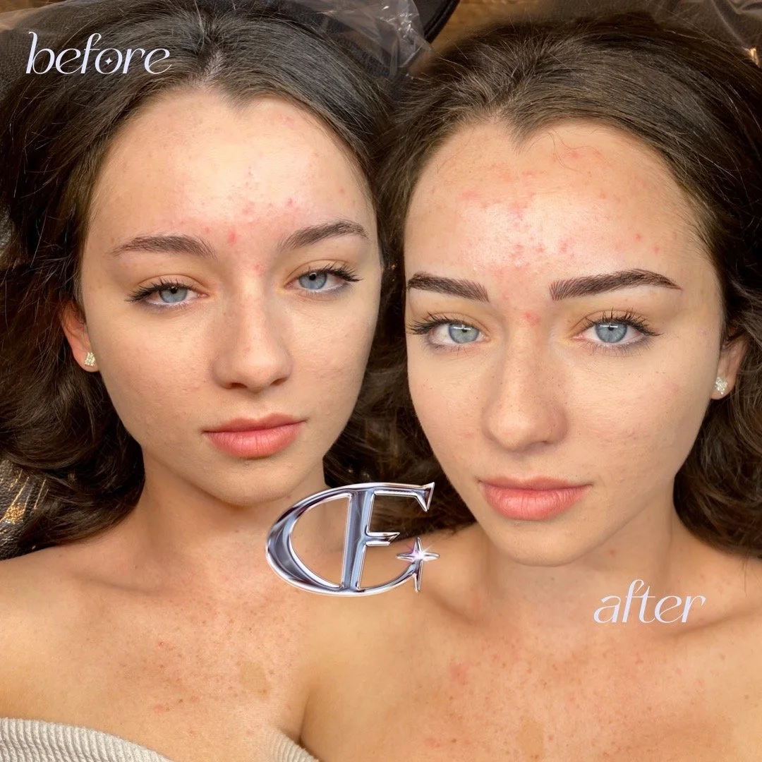 Before and After Photos: Real Results of Brow Permanent Makeup ...