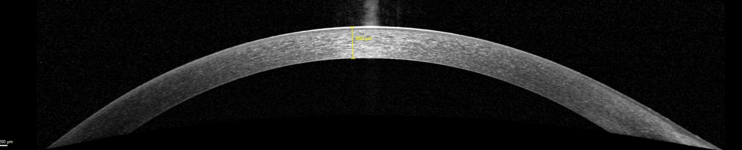 Ocular Biometry — Ophthalmic Clinical Trials