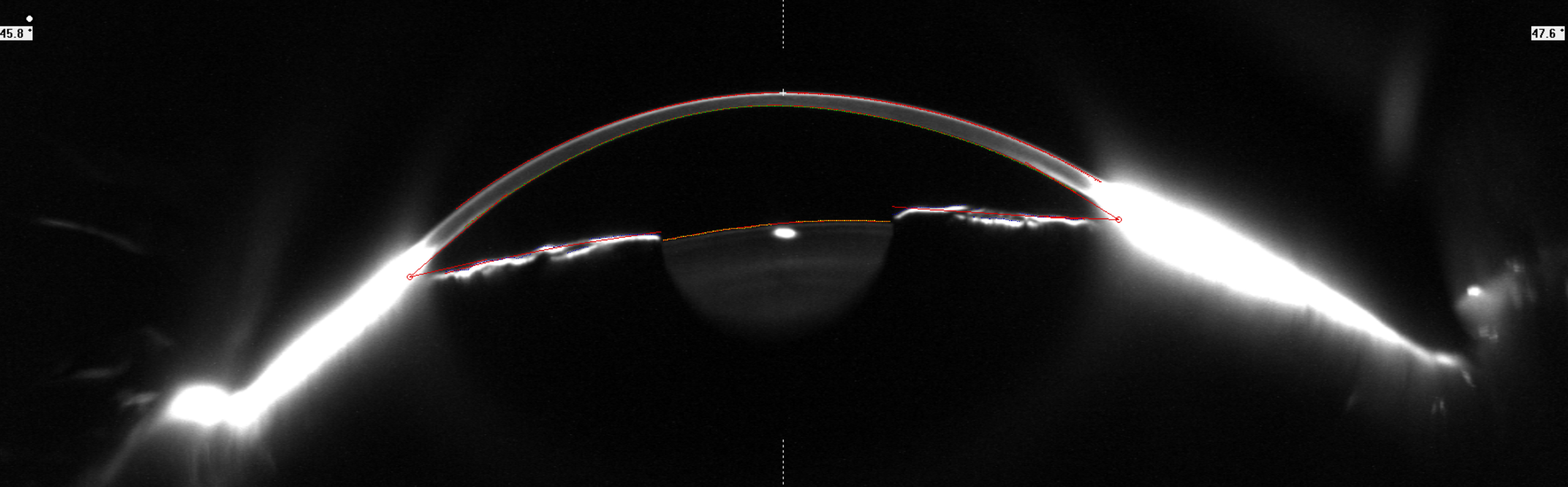 Ocular Biometry — Ophthalmic Clinical Trials