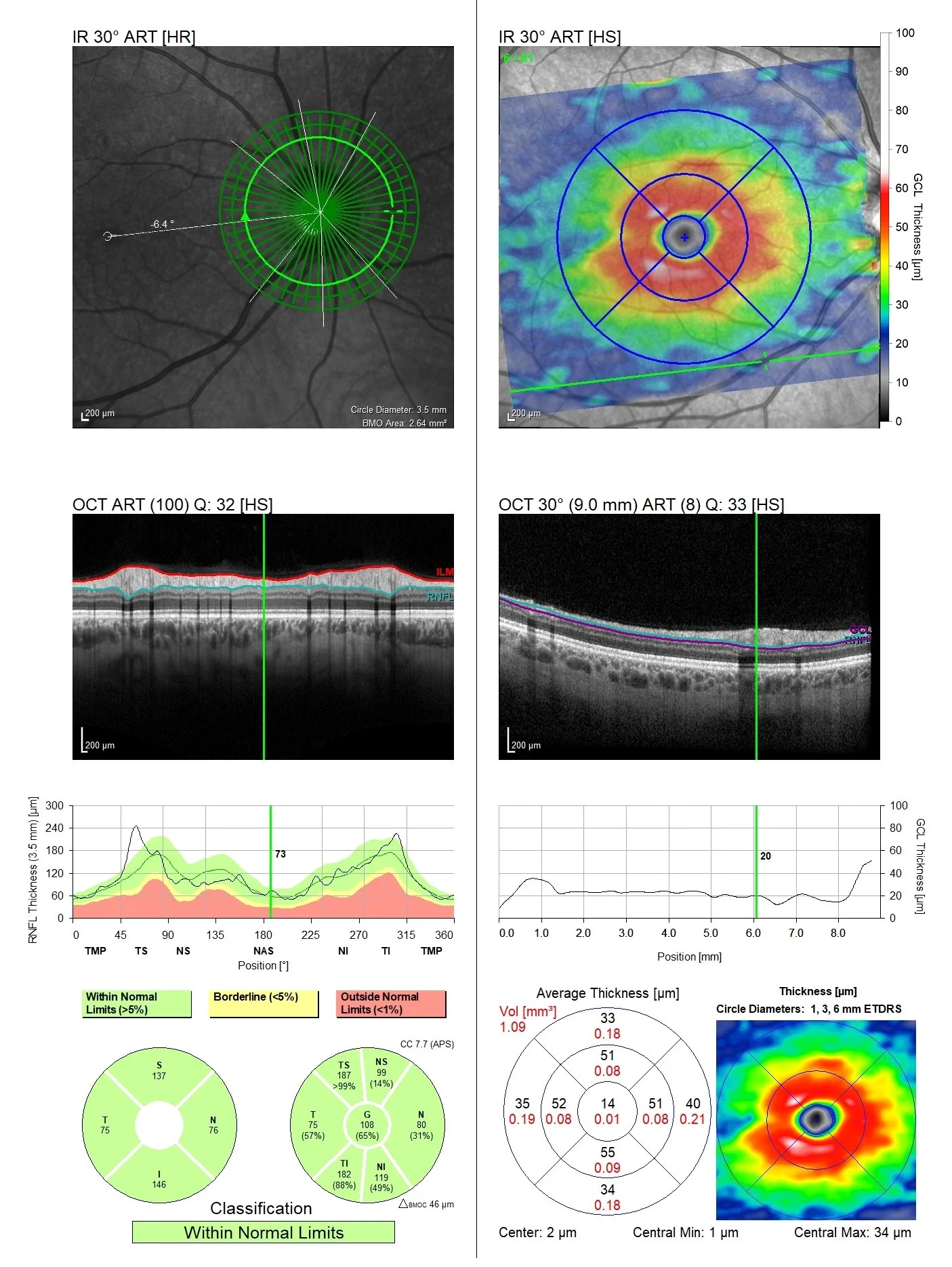 Posterior Eye & Retinal Imaging — Ophthalmic Clinical Trials
